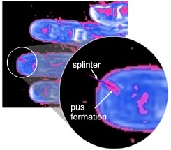 Organ Systems: Bodily Defense - PEER Program (Youth STEM Promotion)